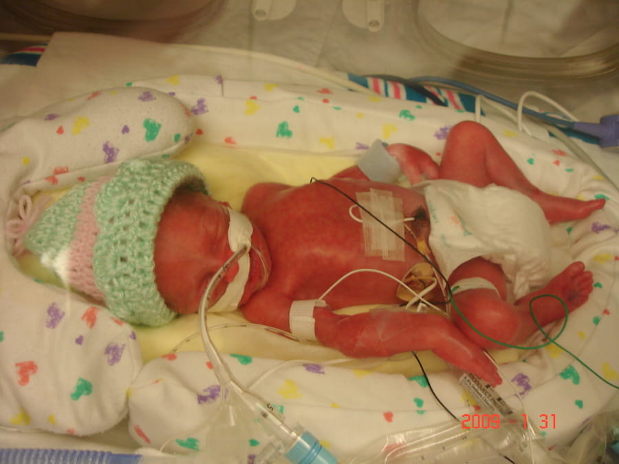 Blessed with tiny treasures: Carson and Kendall’s story - Orlando ...